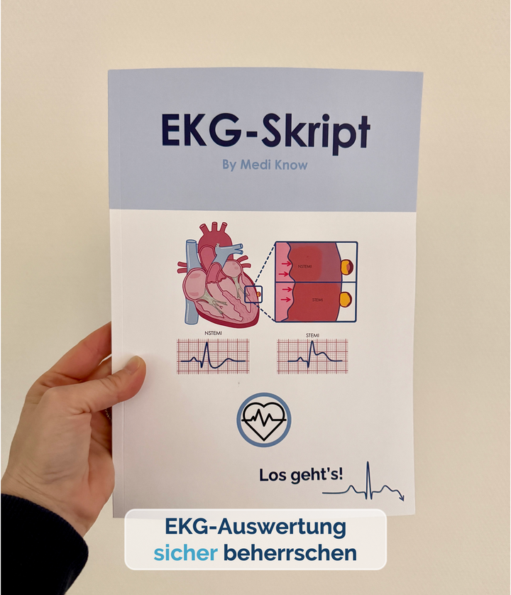 Vorhofflimmern und Vorhofflattern unterscheiden – Medi Know